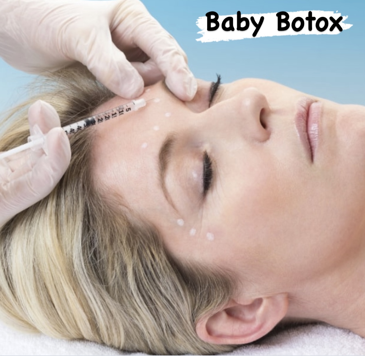 Baby/Micro Botox - Dr Christos Pallouras Dermatology and Medical Laser ...